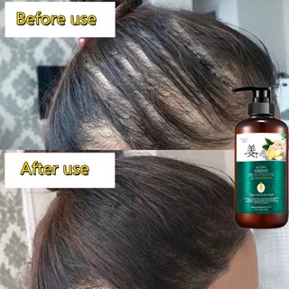 Jual sampo anti-rambut rontok /sampo anti ketombe kontrol minyak Shampo /hair care treatment ...