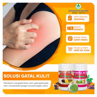 Jual Obat Gatal eksim Exim, Jamur di Selangkangan, Biduran Alergi ...