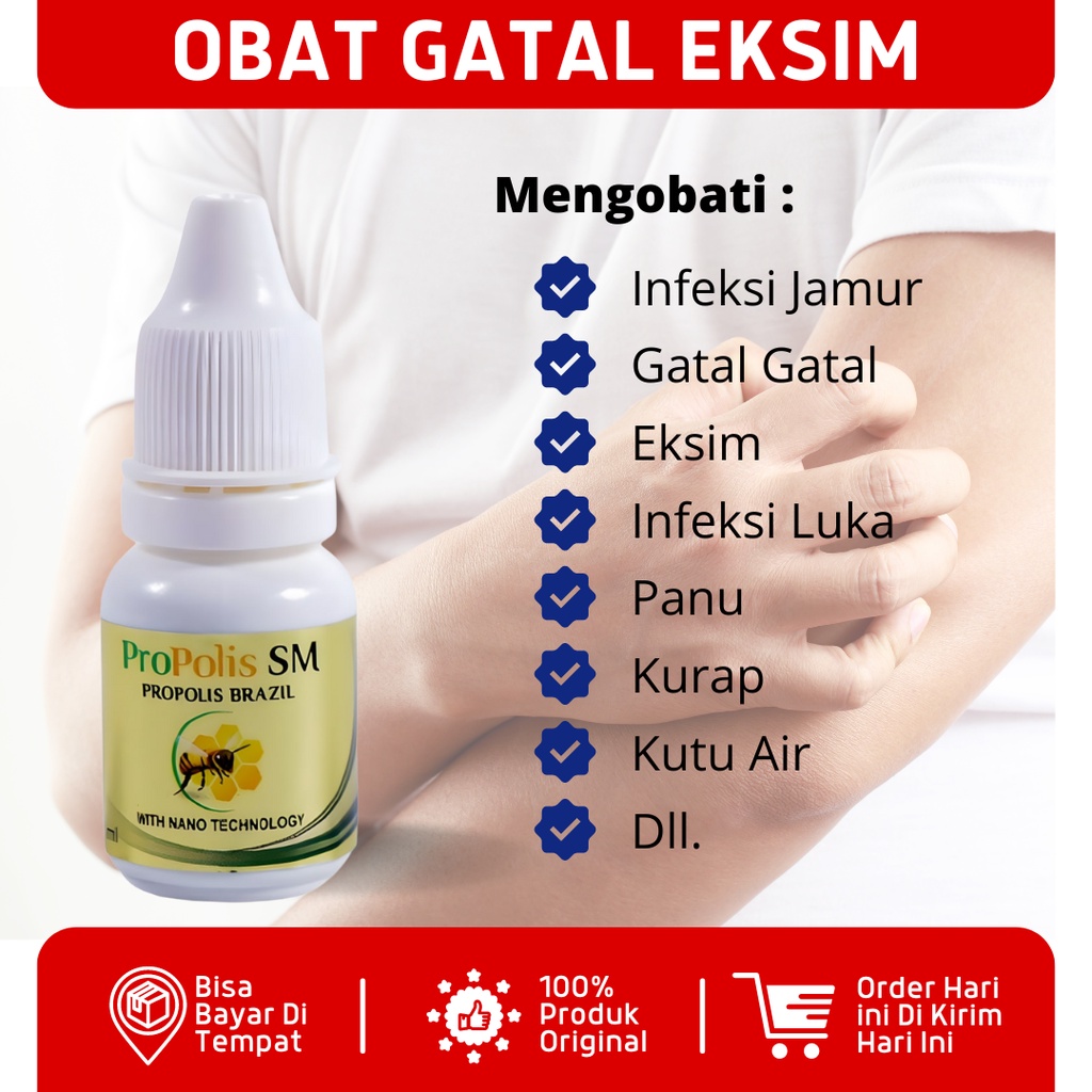 Jual ProPolis SM Brazil - Obat Eksim Kering / Obat Eksim Basah, Eksim ...