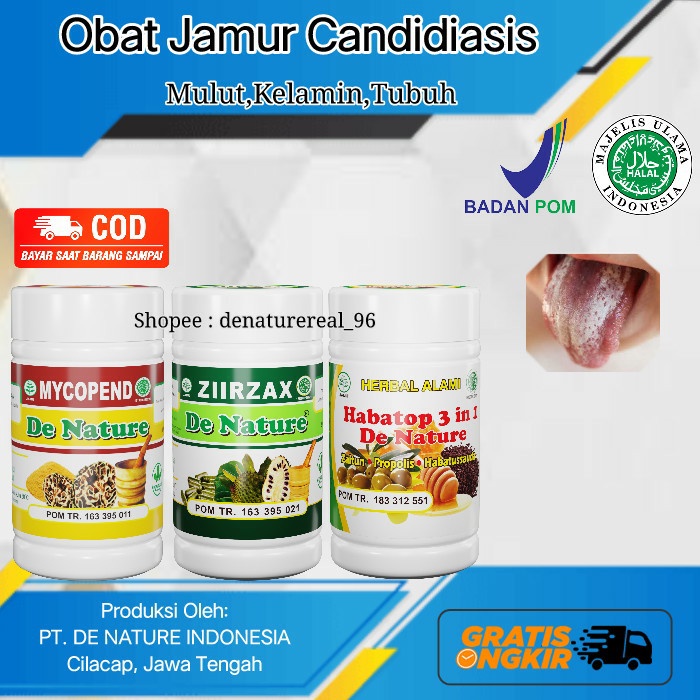 Jual Obat alami untuk Candidiasis/candida Mulut,Bercak putih atau ...