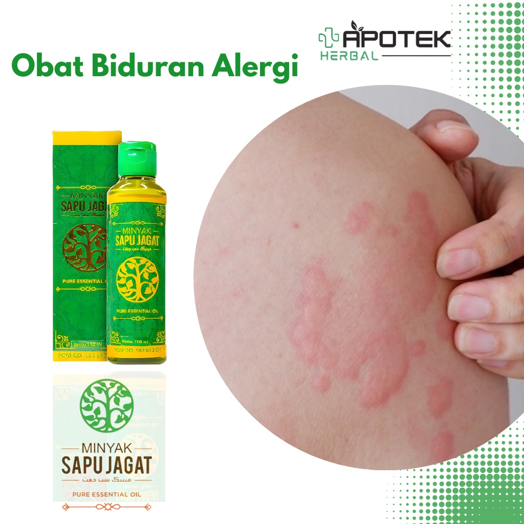 Jual Minyak Sapu Jagat Obat Biduran Alergi 100% Original Obat Kaligata ...