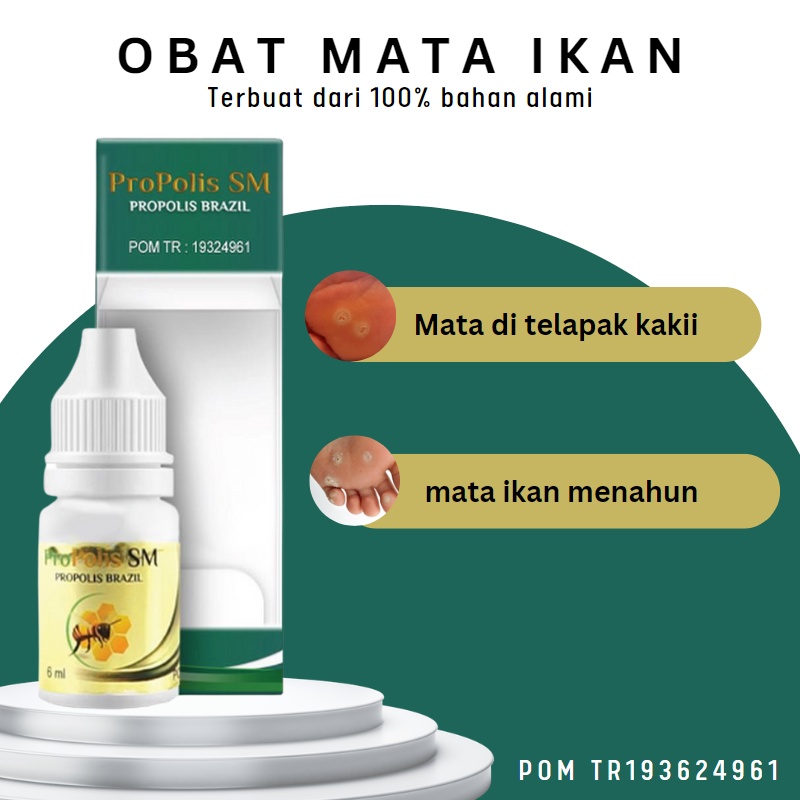 Jual Kaka Herbal - Obat Mata Ikan Di Telapak Kaki, Obat Tetes Mata Ikan ...