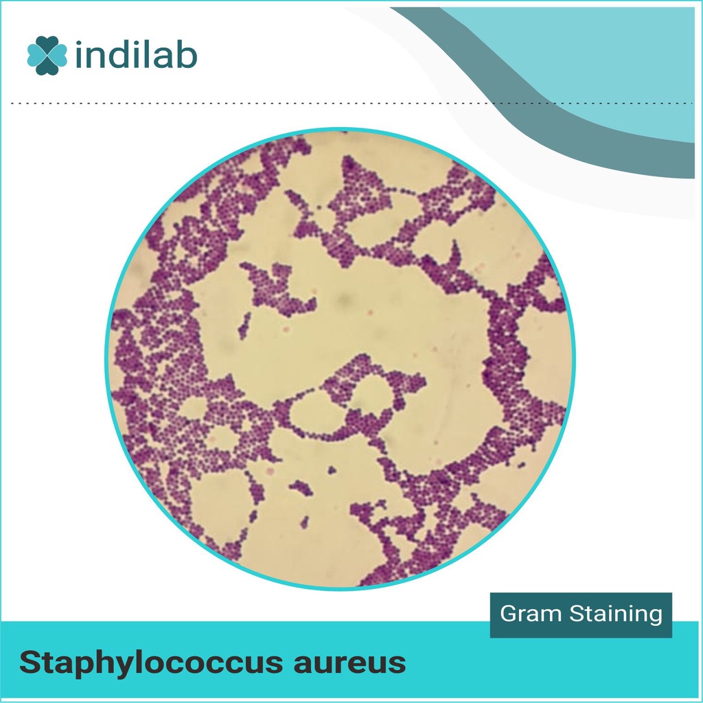 Jual Kultur Isolat murni Staphylococcus aureus ATCC | Shopee Indonesia