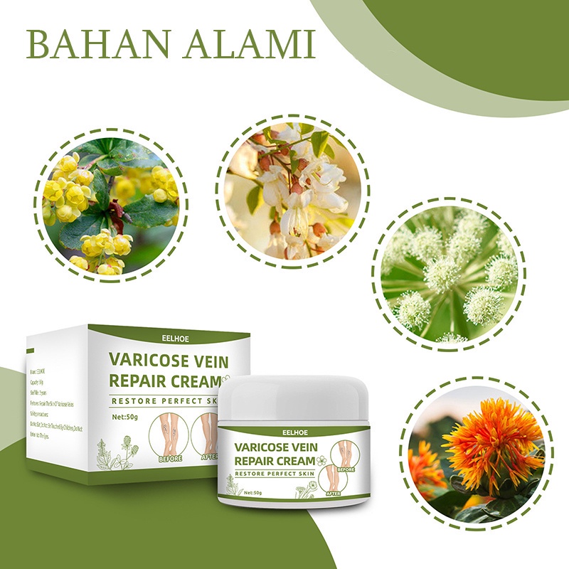 Jual Permanen Krim Varises Varicose Veins Treatment Cream Obat Krim ...