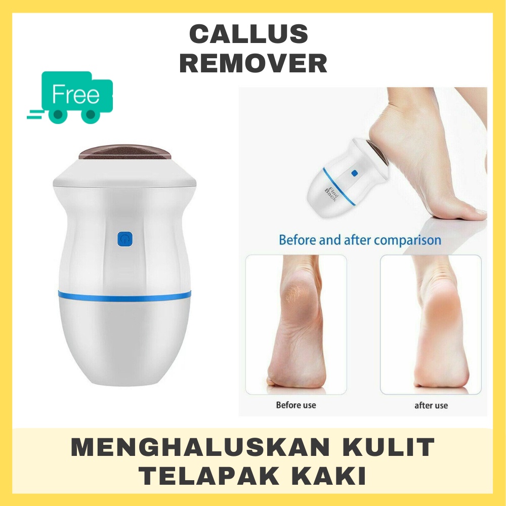 Jual ALAT PEMBERSIH PENGHALUS PERAWATAN TUMIT DAN TELAPAK KAKI KAPALAN ...