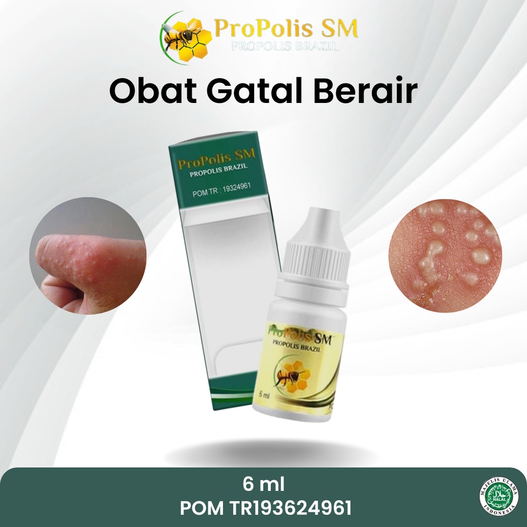 Jual Obat Gatal Berair, Obat Gatal Berair Menyebar, Obat Gatal Berair ...