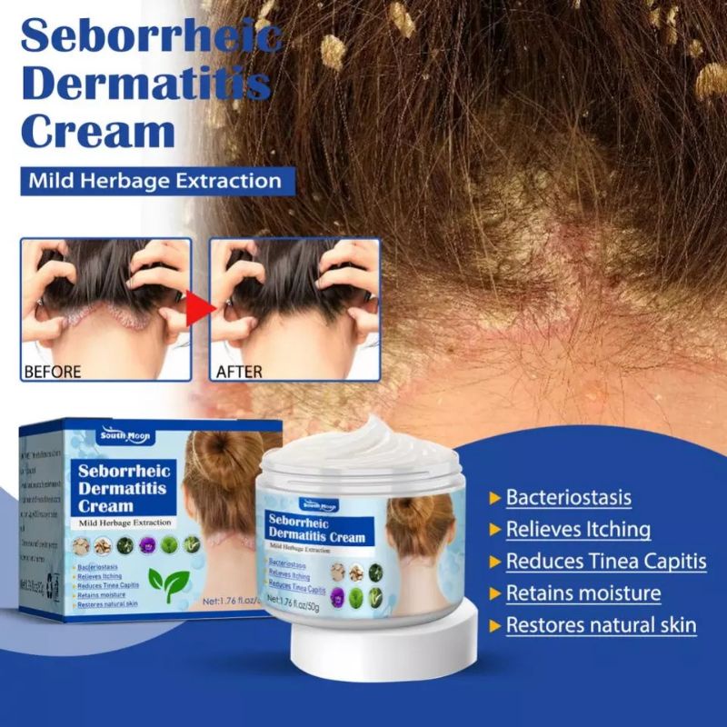 Jual Seborrheic Dermatitis Cream 50g, Krim Kulit Gatal Non-iritasi ...