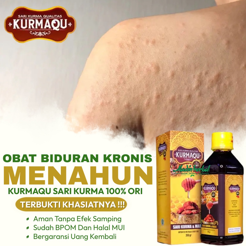 Jual Obat Kaligata Terlengkap & Harga Terbaru Desember 2022 | Shopee ...