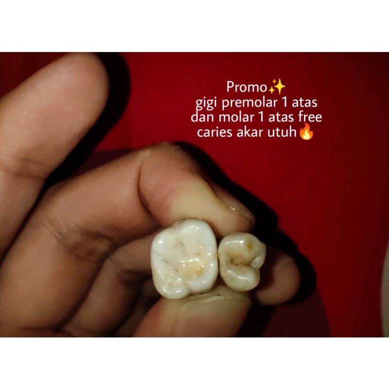 Jual Gigi Praktikum Molar 1 atas dan premolar 1 atas ( PROMO) | Shopee Indonesia