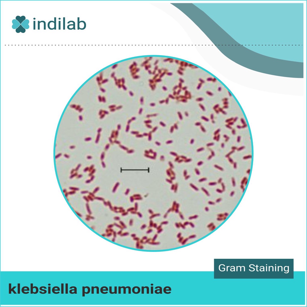 Jual Kultur Isolat murni klebsiella pneumoniae | Shopee Indonesia