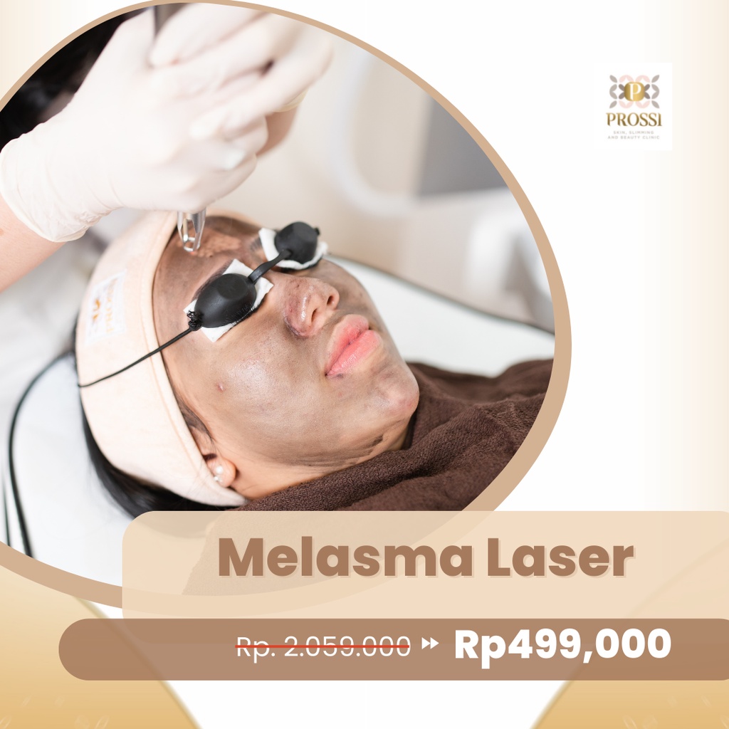 Jual Melasma Laser - Voucher Treatment Prossi Clinic - (Flek Hitam ...