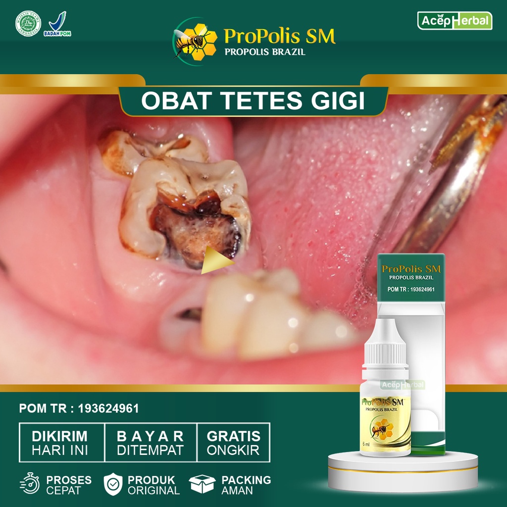 Jual Obat Gigi Berlubang Gusi Bengkak Sakit Berdarah Ngilu Penghilang ...