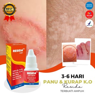 Jual Obat Panu Paling Ampuh 100 Resida Original Asli Bpom Gatel ...