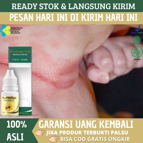 Harga ruam leher pada bayi Terbaru Nov 2025 | BigGo Indonesia