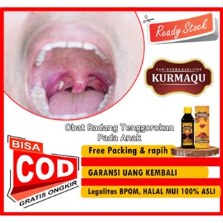 Jual Obat Radang Tenggorokan Pada Anak, Penyakit Amandel, Obat Radang ...