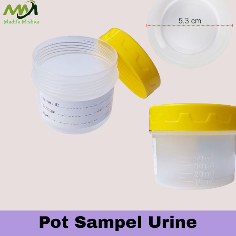 Jual Sample Container atau Pot Urine Tutup penampung urinal | Shopee ...