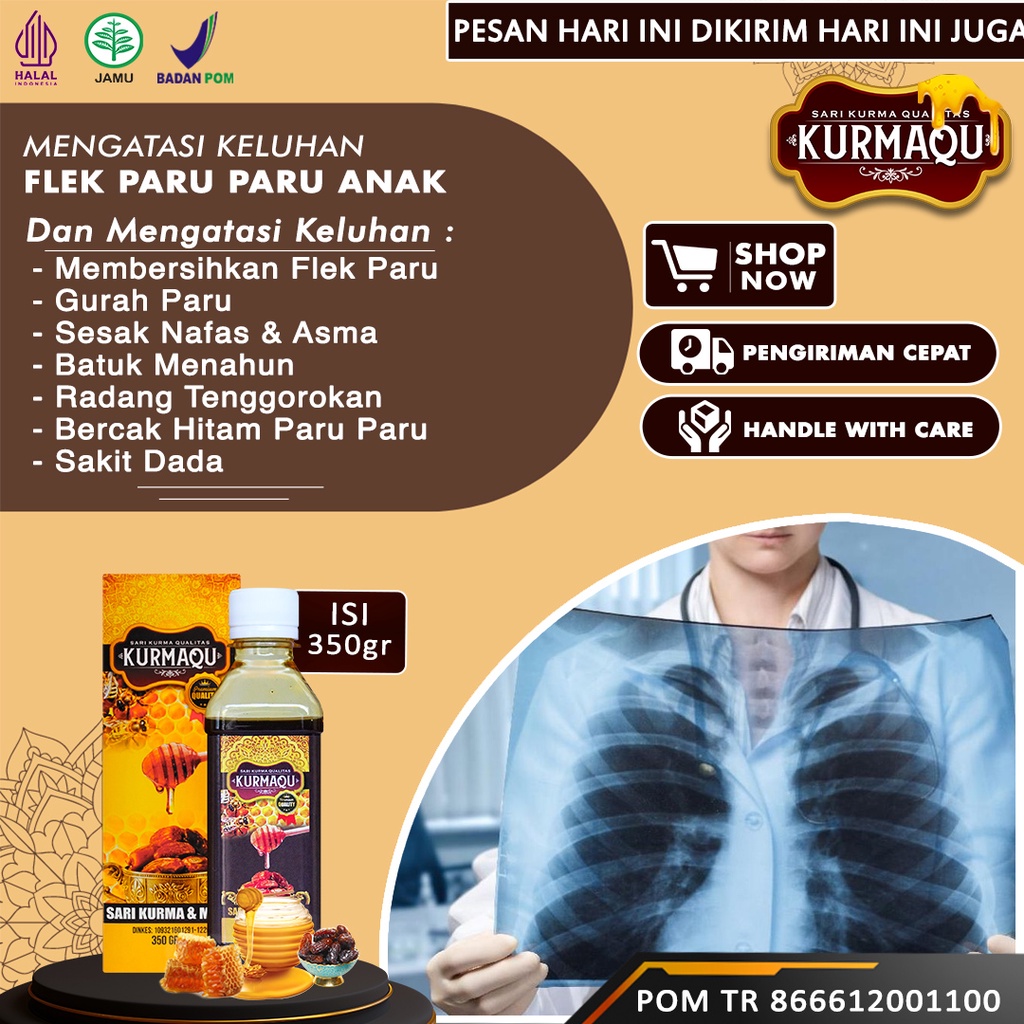 Jual Obat Flek Paru Paru Anak Dan Dewasa Penghilang Bercak Hitam Paru ...