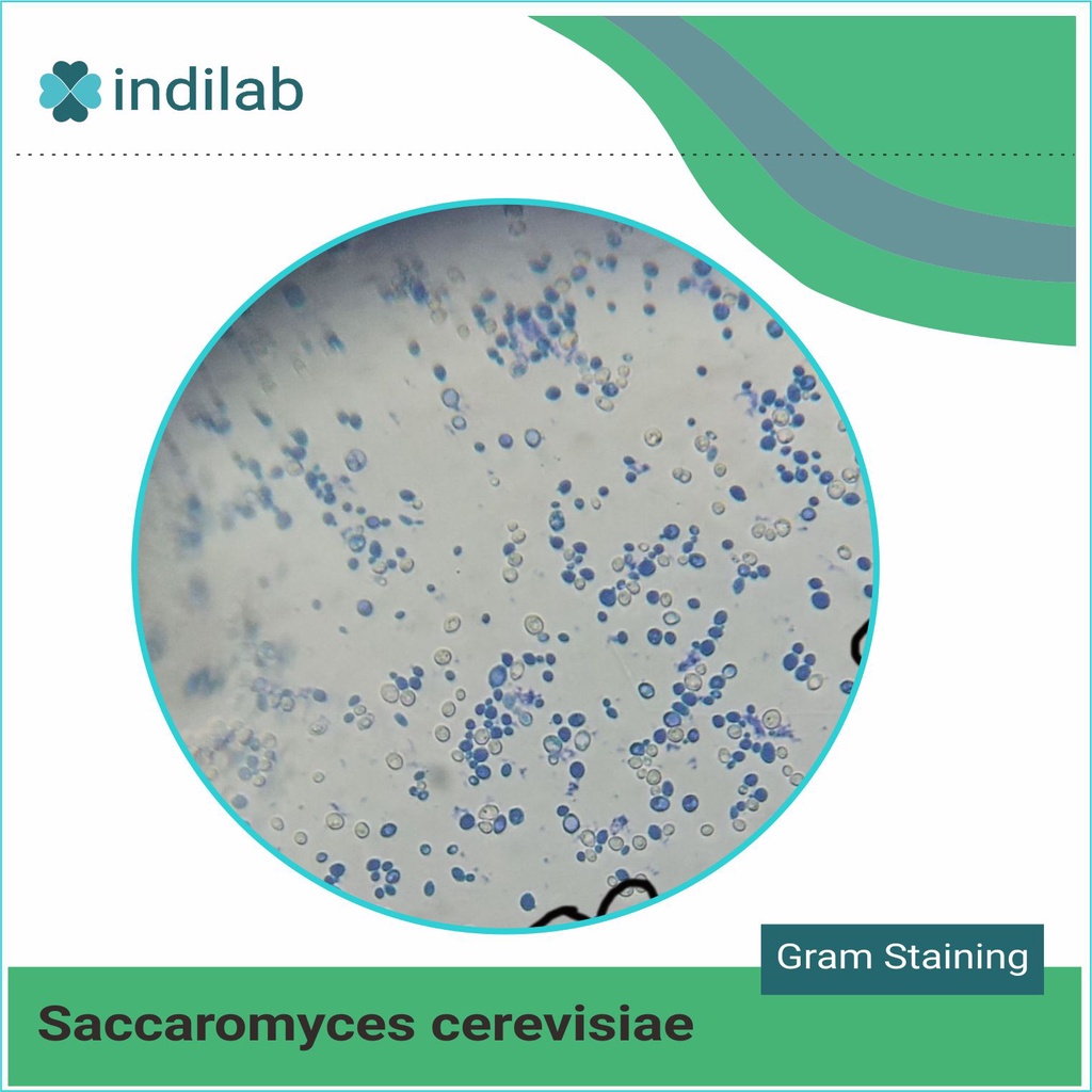 Jual Kultur isolat jamur Saccaromyces cerevisiae | Shopee Indonesia