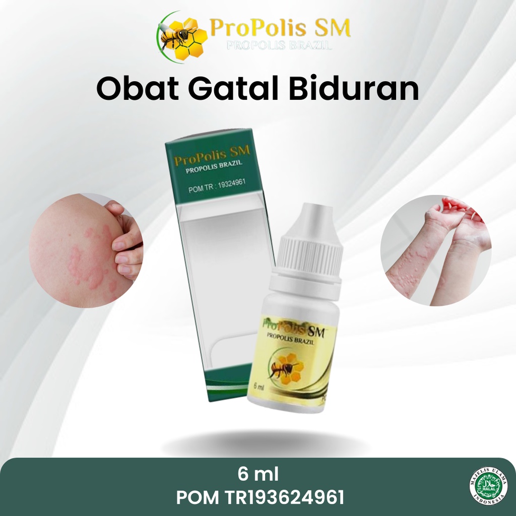 Jual Obat Biduran Gatal Gatal Alergi Dingin Makanan Kaligata Bentol ...