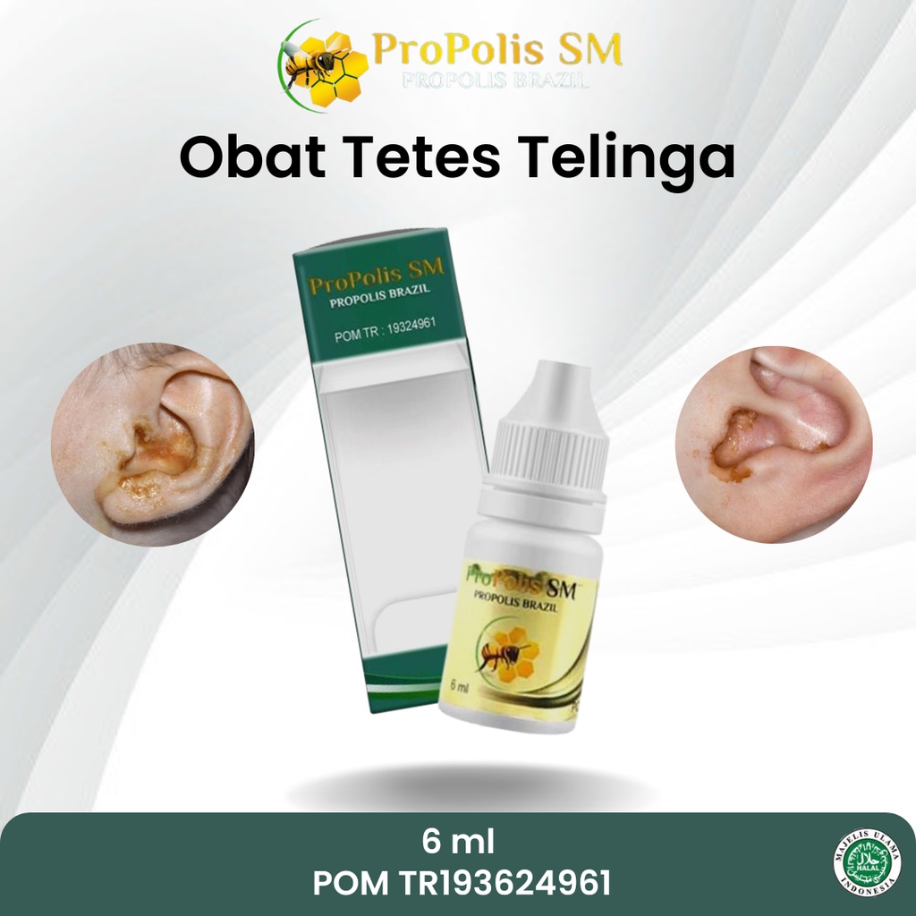 Jual Obat Tetes Telinga Berair Congek Bernanah Dan Bau Busuk Curek ...