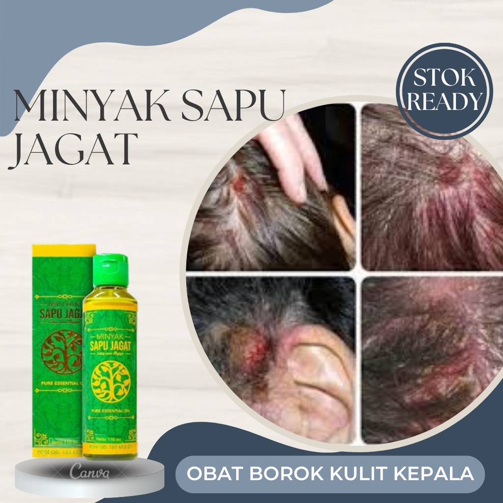 Jual Obat Kulit Kepala Borok, Obat Jamur Kulit Kepala, Obat Kepala Bersisik, Obat Kurap Di Kulit ...