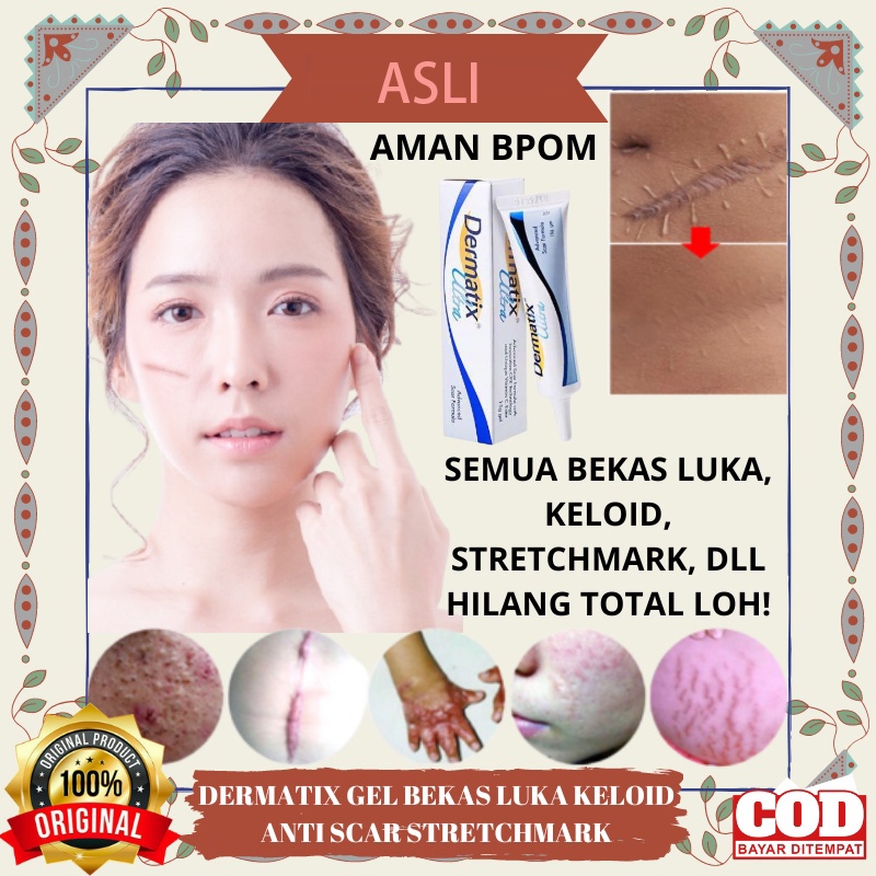 Jual Dermatix Advance Krim Penghilang Bekas Luka Jerawat Dan Stretch ...