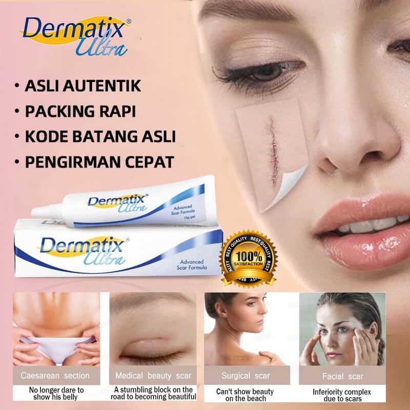 Jual Dermatix Ultra Penghilang Bekas Luka Keloid ANTI SCAR Stretchmark ...