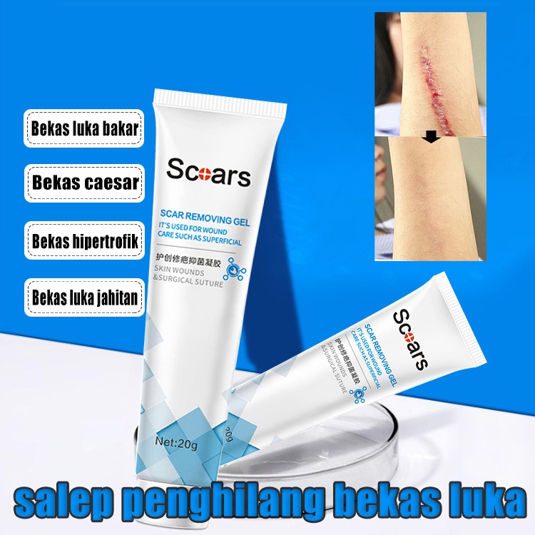 Jual penghilang bekas luka Krim bekas luka menghilangkan Bekas Luka ...
