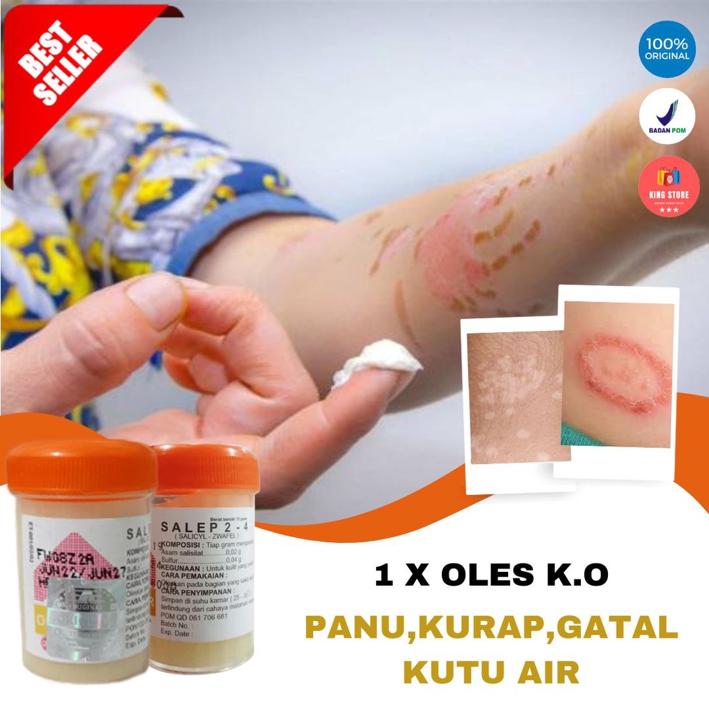 Jual Obat Panu Paling Ampuh 100 Salep Zwafel Gatal Original Sulfur ...