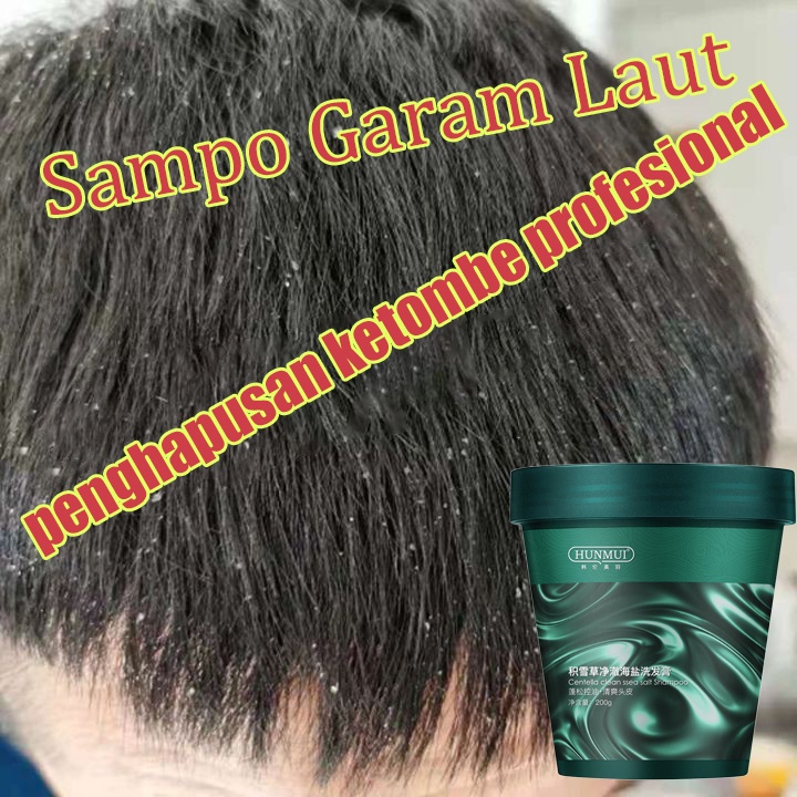 Jual Centella Sampo Anti Ketombe 99% Garam Laut Anti Ketombe Yang Ampuh Shampoo Anti Ketombe Dan ...