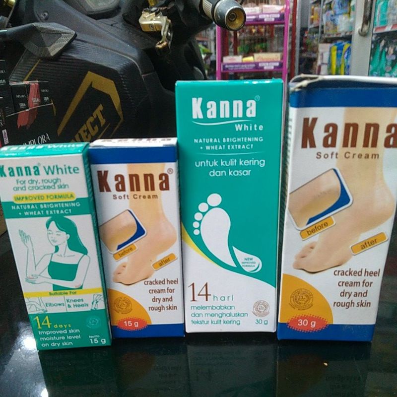 Jual KANNA WHITE,KANNA SOFT CREAM 15G DAN 30G BPOM | Shopee Indonesia Jual KANNA WHITE,KANNA SOFT CREAM 15G DAN 30G BPOM | Shopee Indonesia