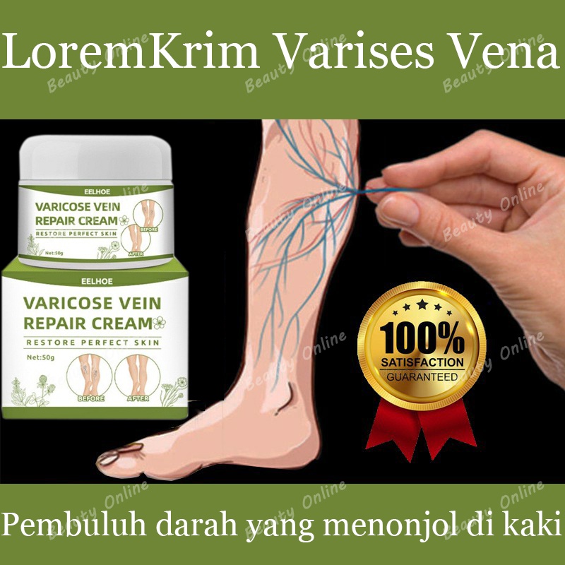 Jual Varises Cream Permanen Krim Varises Angiitis Salep Flebitis Kaki ...