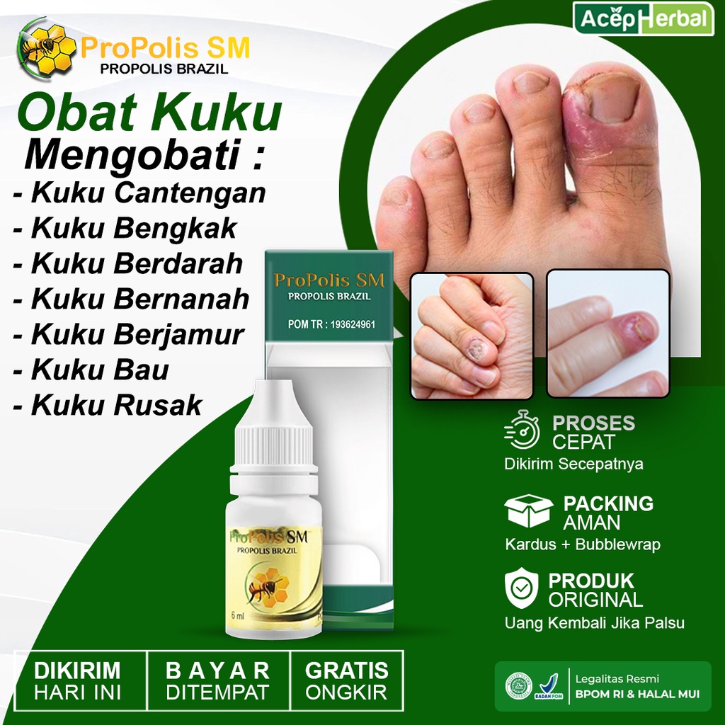 Jual Obat Jamur Kuku Terlengkap & Harga Terbaru Desember 2022 | Shopee ...