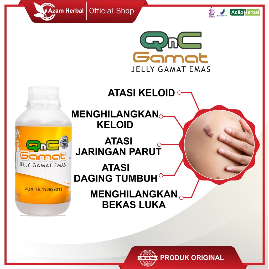 Jual Obat Keloid Penghilang Keloid Daging Tumbuh Bekas Luka Jaringan ...