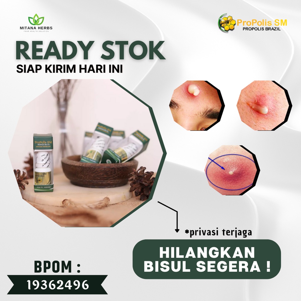 Jual Mitana Herbal / Obat Bisul / Bisul Di Pantat / Obat Bisul Bayi ...