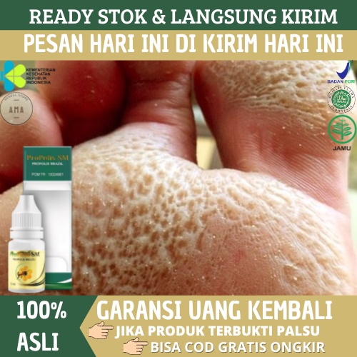 Jual Obat Kaki Rayapan, Obat Kaki Rayapan Dan Bau, Obat Telapak Kaki ... Jual Obat Kaki Rayapan, Obat Kaki Rayapan Dan Bau, Obat Telapak Kaki ...