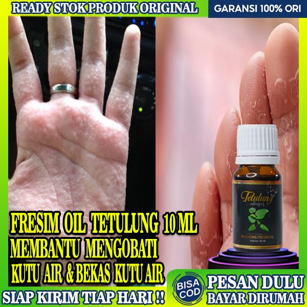 Jual Obat Kutu Air di Kaki,Obat Kutu Air Penghilang Kuman Air,Fresim ...