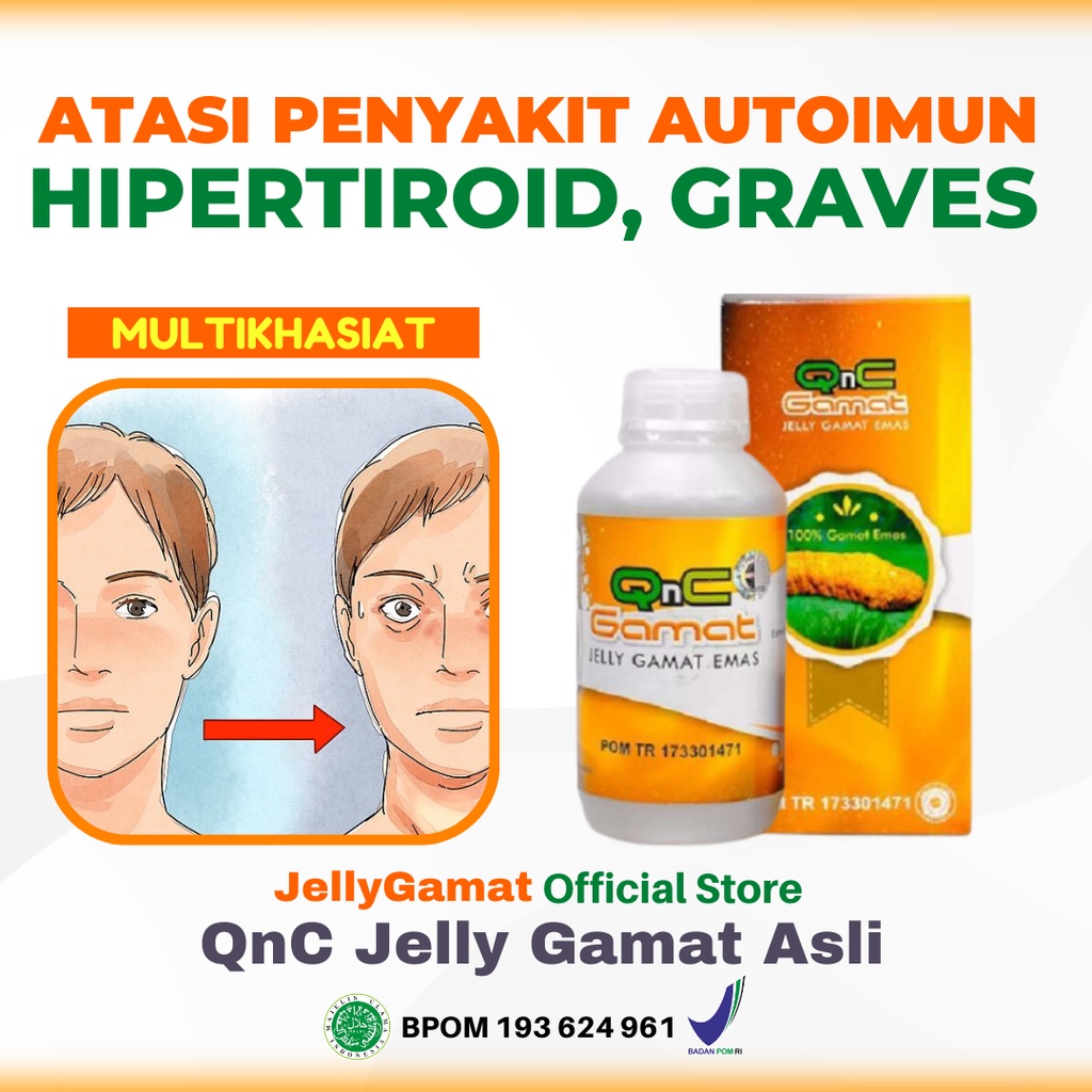 Jual Obat Penyaki Graves Penyakit Autoimun Kelebihan Hormon Tiroid ...