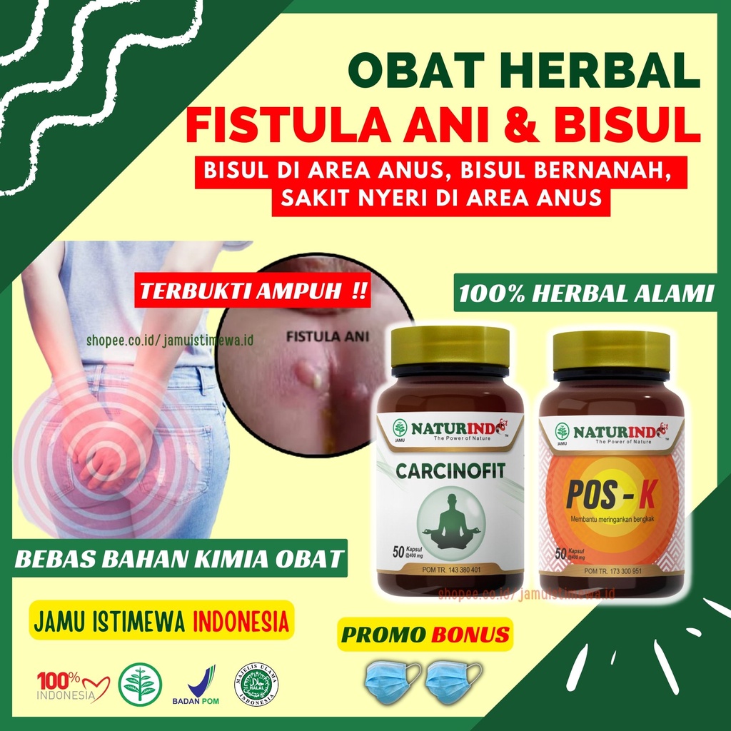 Jual Obat Fistula Ani Bisul di Pantat Bisul Bernanah Herbal Ampuh Abses ...