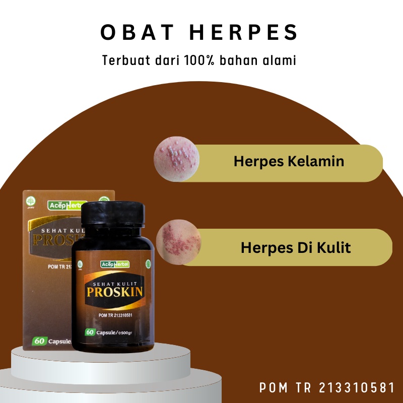 Jual Kaka Herbal - Obat Herpes Kulit, Obat Herpes Genital, Obat Herpes ...