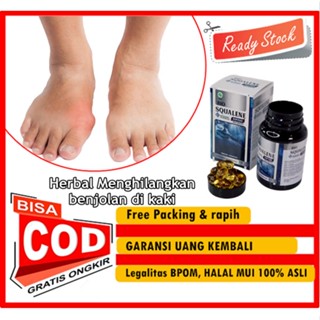 Jual BIO SQUALENE - Herbal Menghilangkan benjolan di kaki, Obat bunion ...