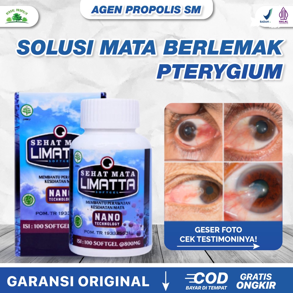 Jual Obat Mata Berlemak Pterygium Penghilang Lamad Di Mata Sehat Mata Limatta | Shopee Indonesia