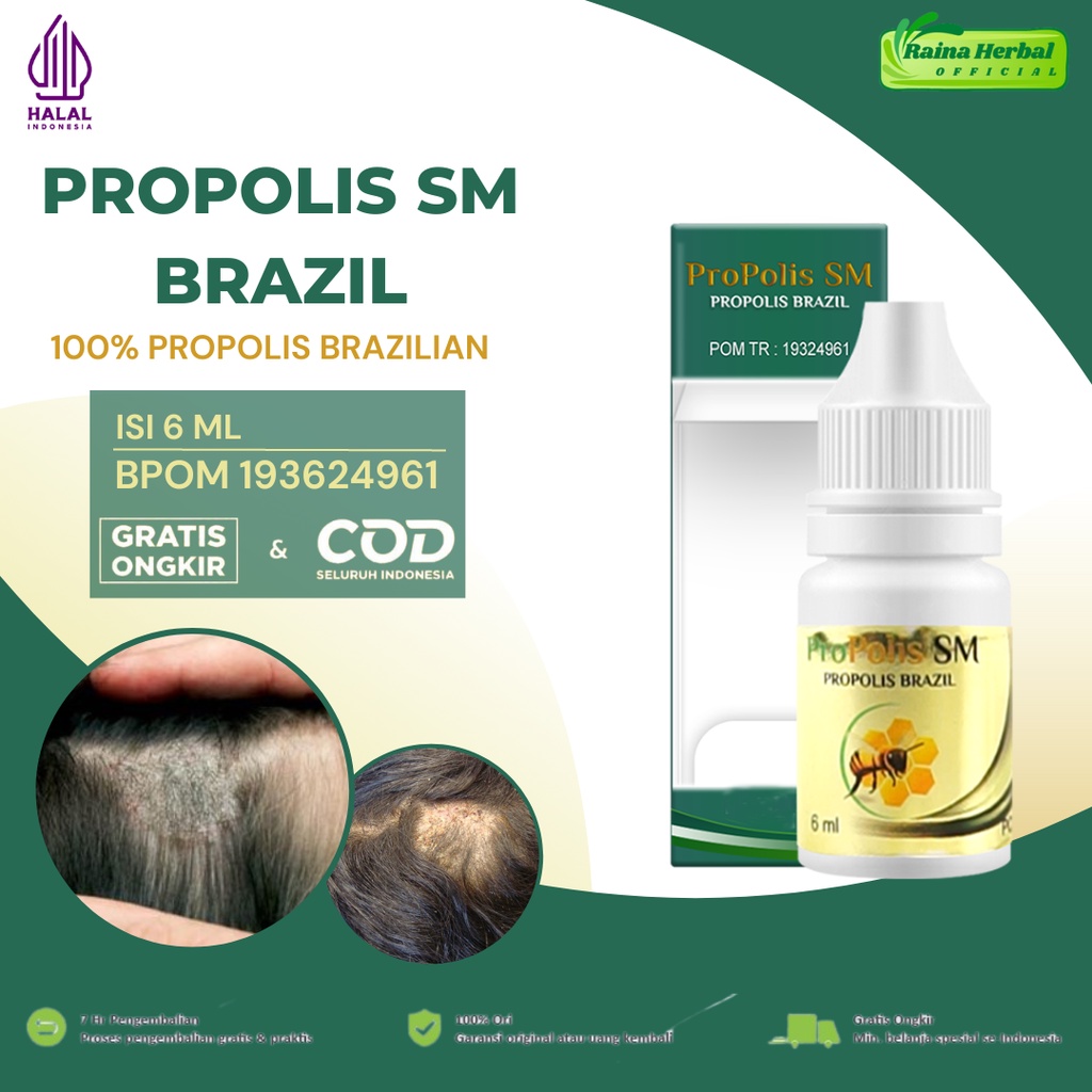 Jual Raina Herbal - Obat Kulit Herbal Untuk Jamur Kepala Gatal Kering Bersisik Berkerak Dan ...