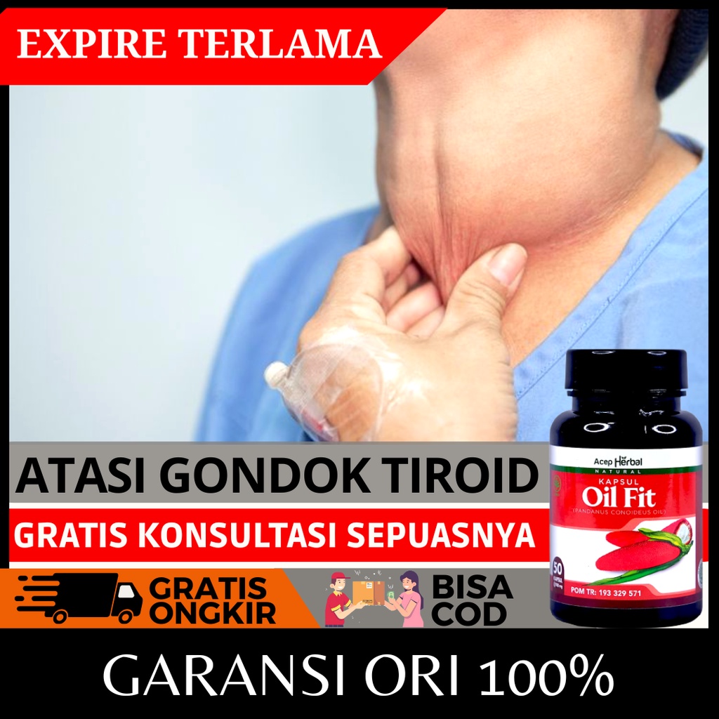 Jual Obat Gondok Tiroid di Leher Herbal Gondokan Beracun Anak dan ...
