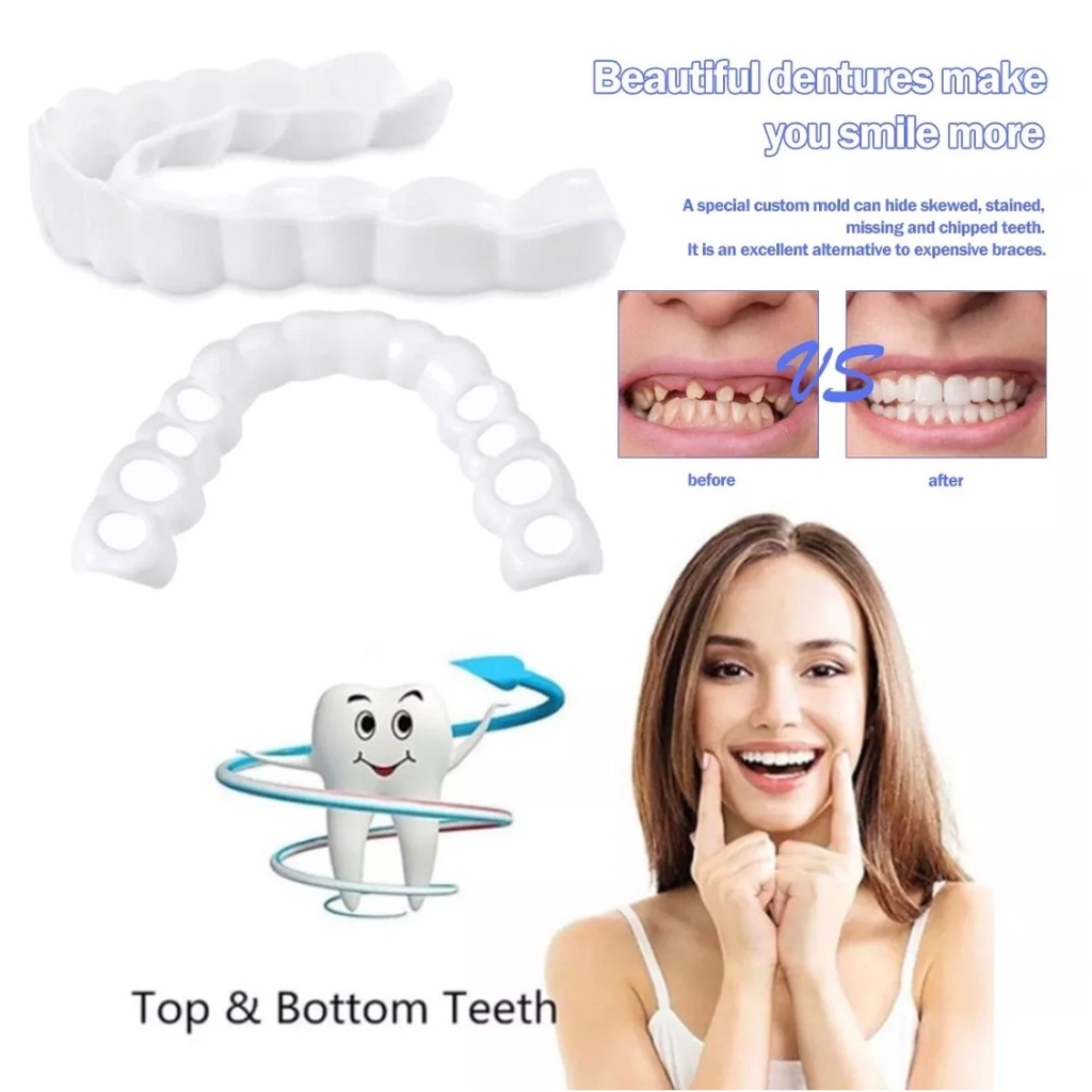 Jual Gigi Palsu 1 Set Atas Bawah Veneer Gigi Palsu Silikon | Shopee ...