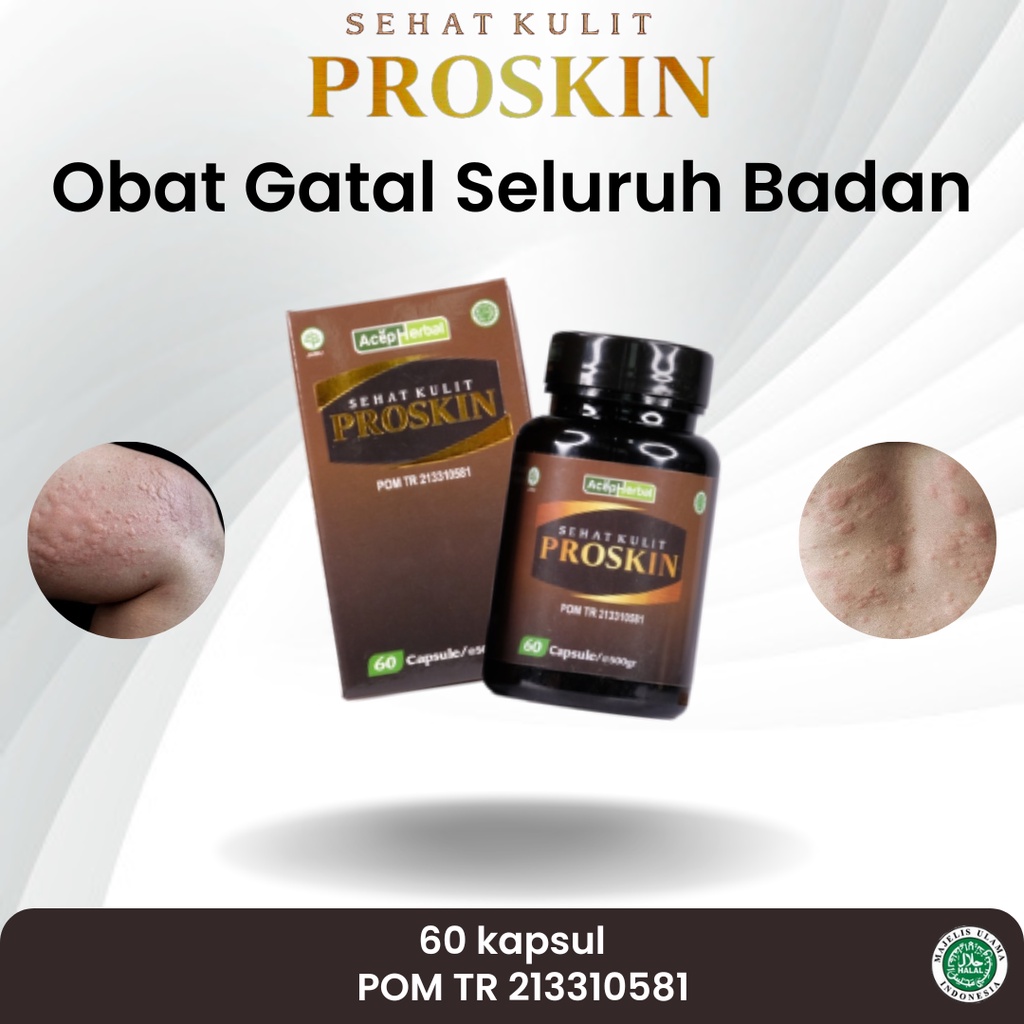 Jual Obat Gatal Seluruh Badan, Korengan, Budug Bernanah, Gatal ...