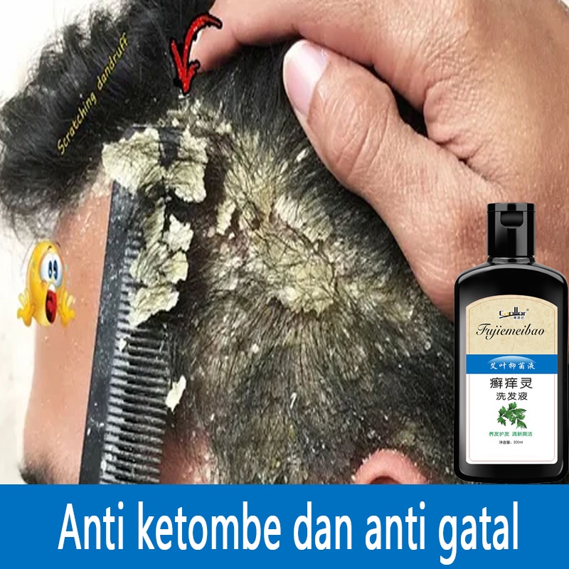 Jual sampo anti ketombe shampo anti ketombe gatal anti ketombe anti bakteri shampoo tungau ...