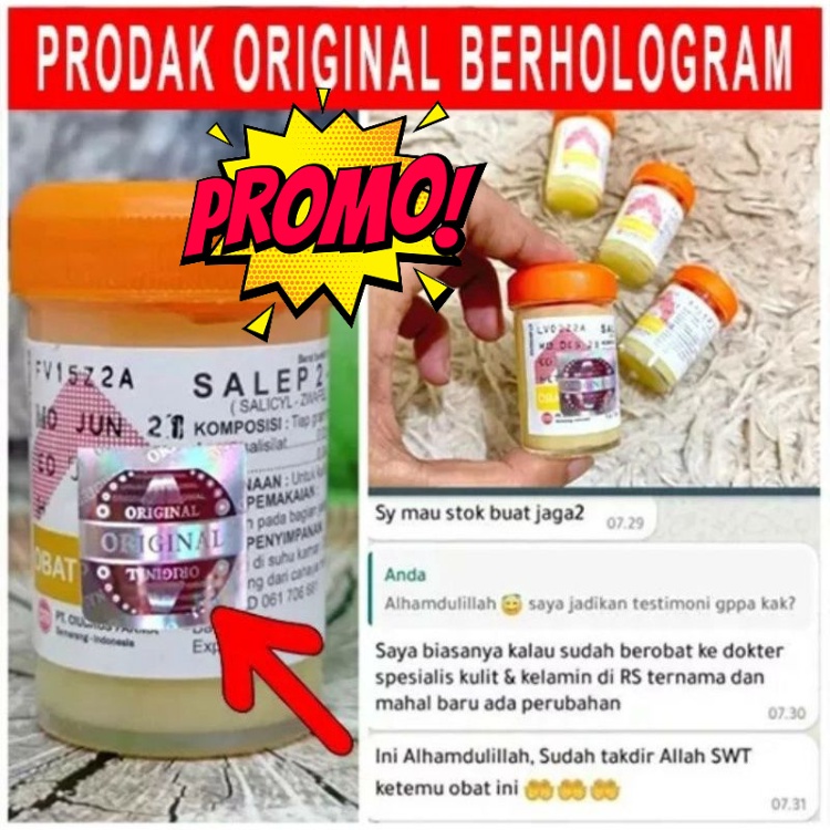 Jual Salap Gatal Saleb Zwafel Obat Gatel Selangkangan Skabies Eksim ...