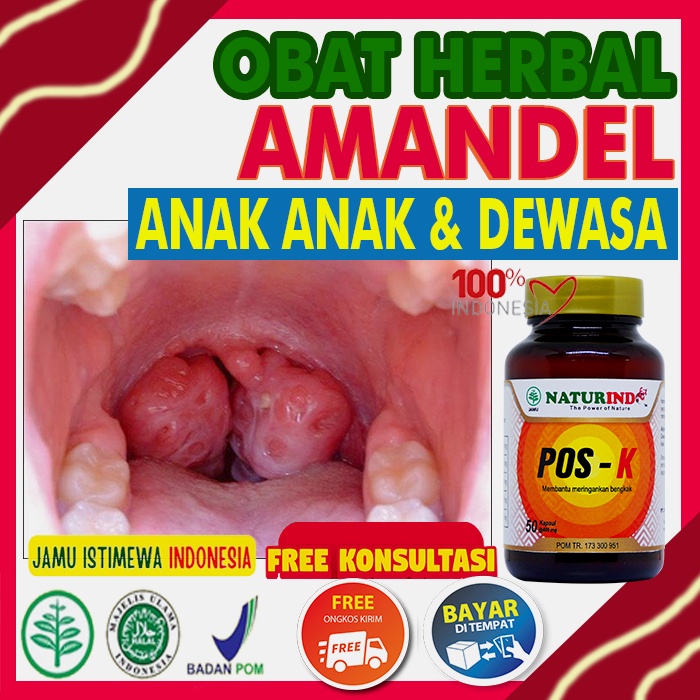 Jual Obat Amandel Kronis Paling Ampuh Untuk Anak Dewasa Tanpa Operasi ...