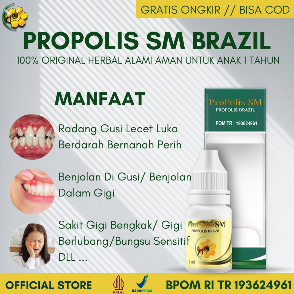 Jual Obat Radang Gusi Anak Dewasa Benjolan Di Gusi Bengkak Memar Merah ...